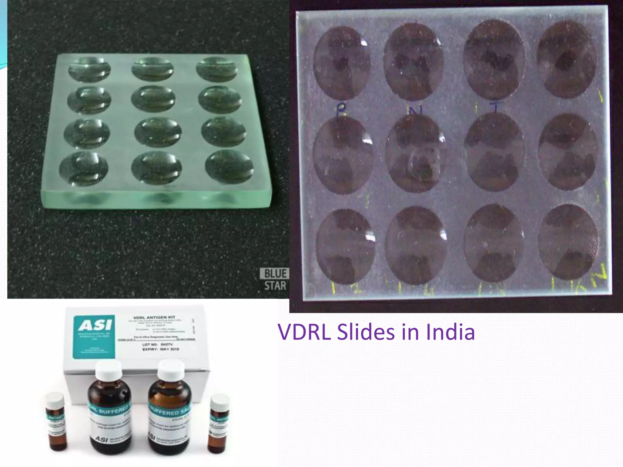 Lab diagnosis of Sexually transmitted Infections (STIs) | PPTX