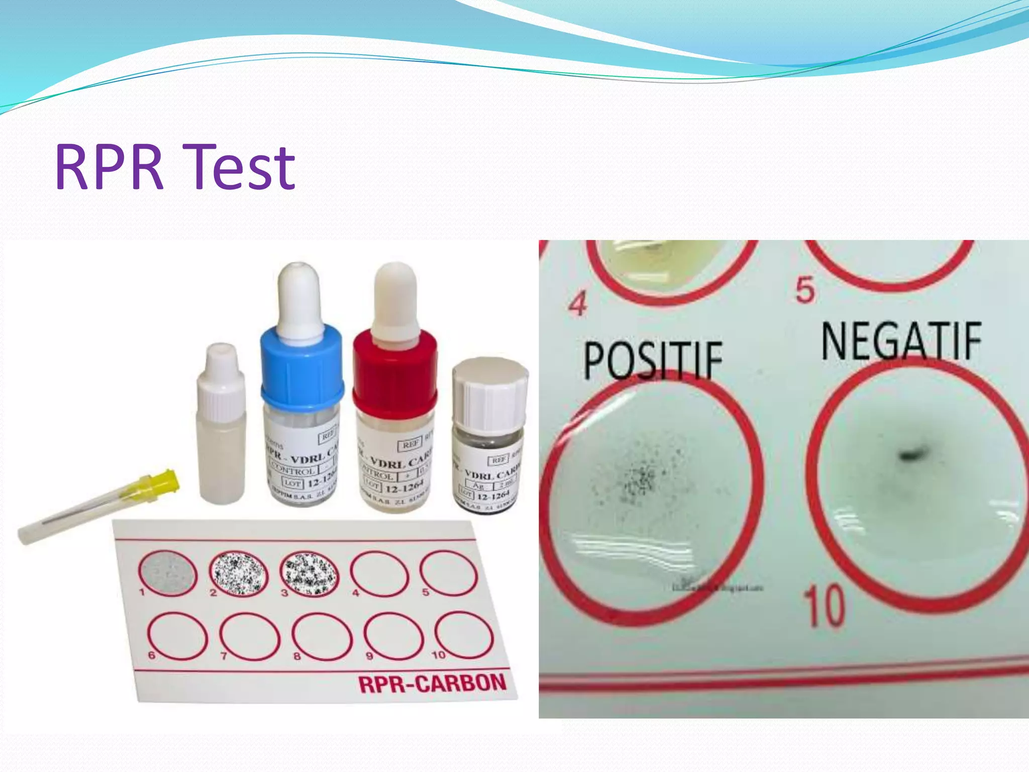 Lab Diagnosis Of Sexually Transmitted Infections Stis Ppt
