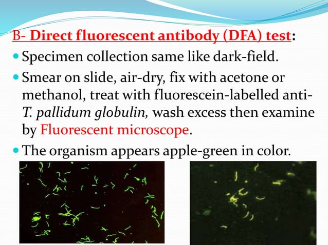 Lab diagnosis of Sexually transmitted Infections (STIs) | PPTX