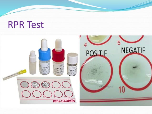 Lab diagnosis of Sexually transmitted Infections (STIs) | PPTX