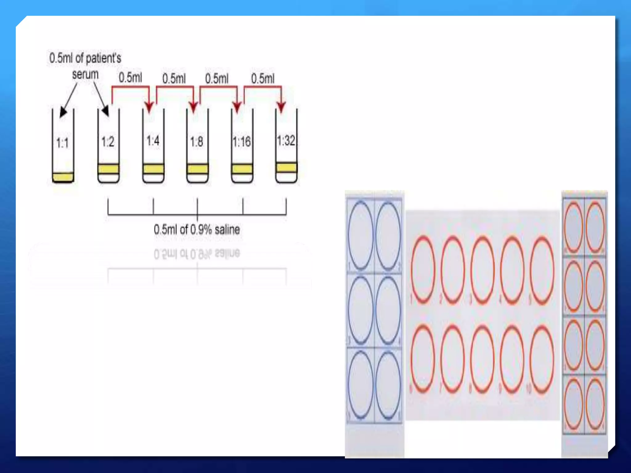 Lab diagnosis of syphilis | PPTX
