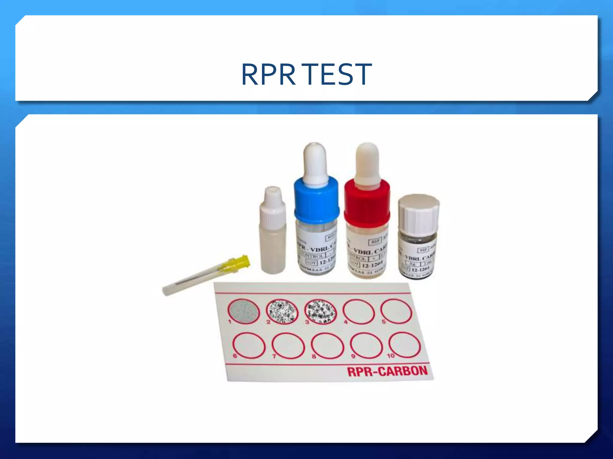Lab diagnosis of syphilis | PPTX