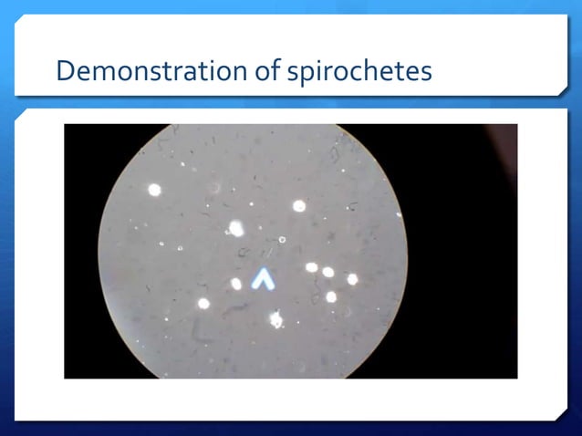 Lab diagnosis of syphilis | PPTX