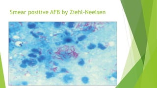 Lab diagnosis of tb dr mostafa lecture | PPTX
