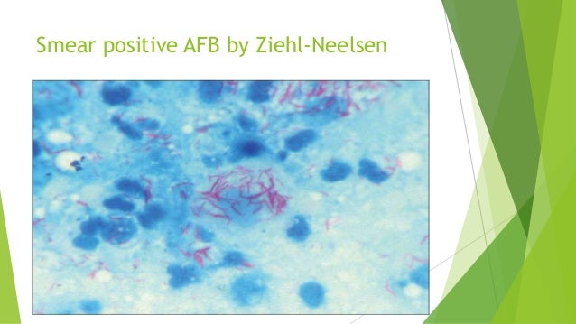 Lab diagnosis of tb dr mostafa lecture
