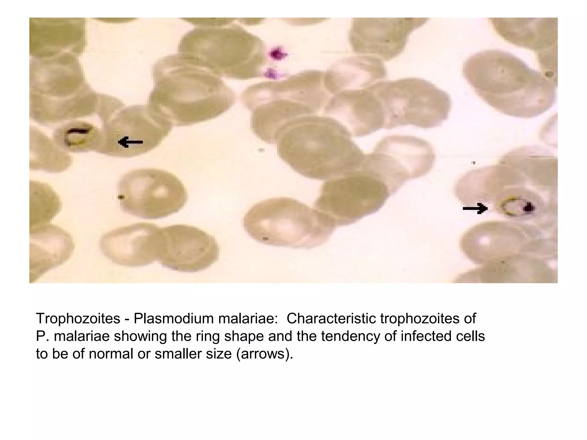 Lab diagnosis of Trematodes, Blood flagellates, Plasmodium and ...