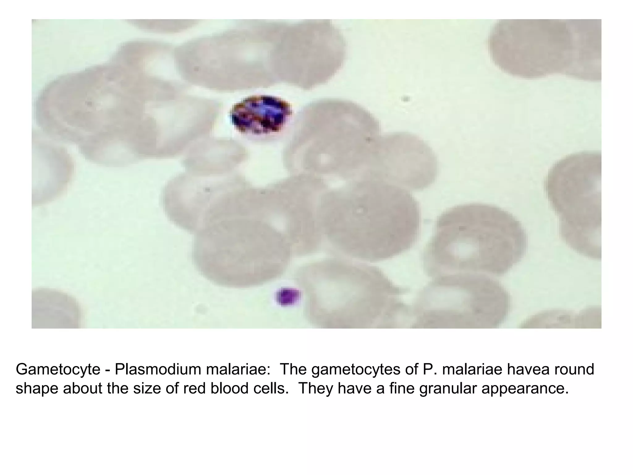 Lab diagnosis of Trematodes, Blood flagellates, Plasmodium and ...