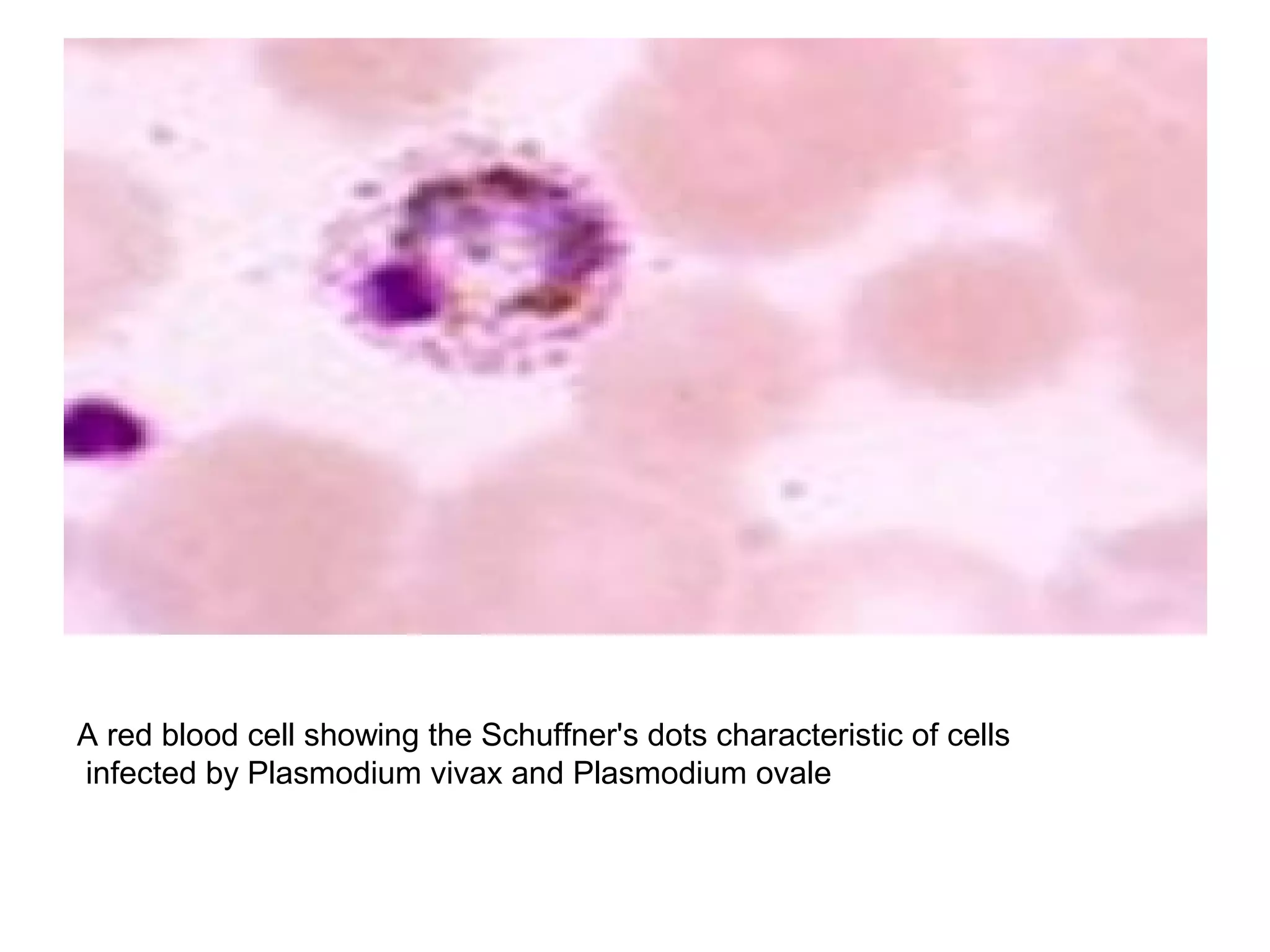 Lab diagnosis of Trematodes, Blood flagellates, Plasmodium and ...