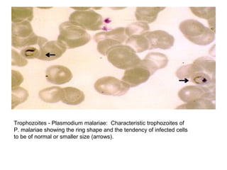 Lab diagnosis of Trematodes, Blood flagellates, Plasmodium and ...