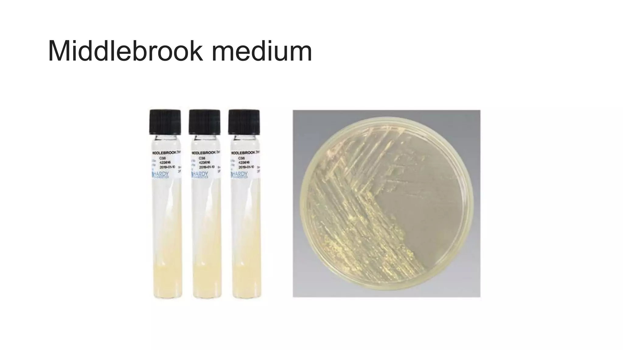 LAB DIAGNOSIS OF TUBERCULOSIS.pptx