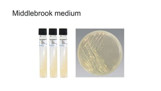 LAB DIAGNOSIS OF TUBERCULOSIS.pptx