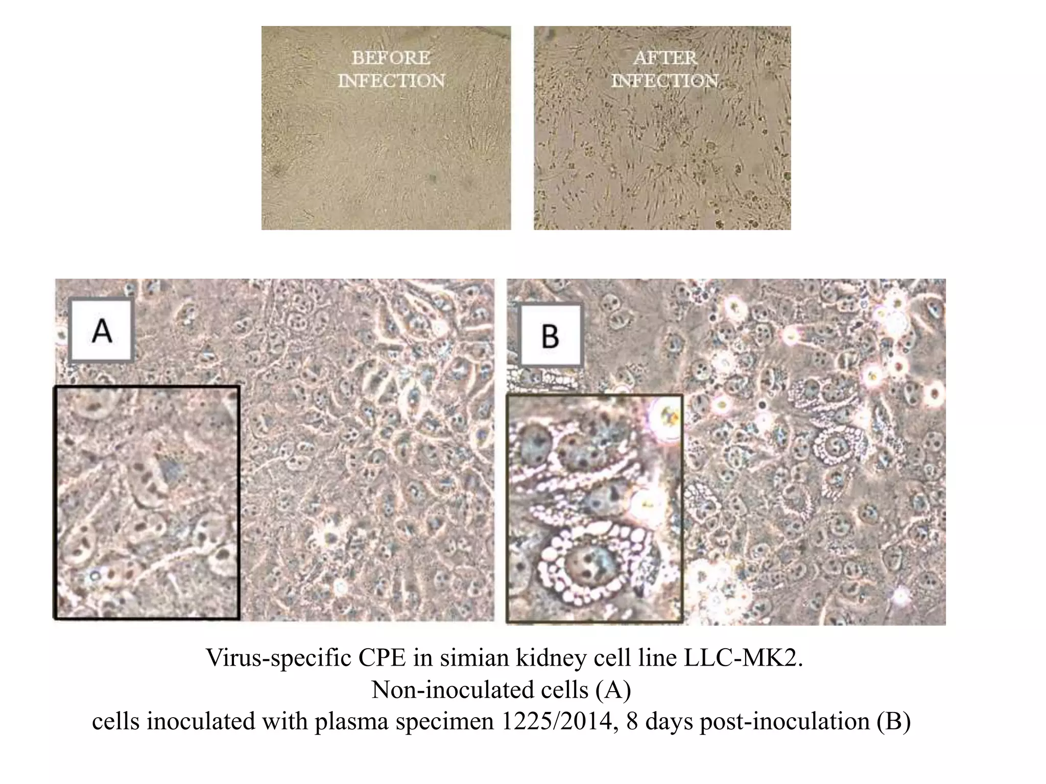 Lab diagnosis of viral infections | PPTX