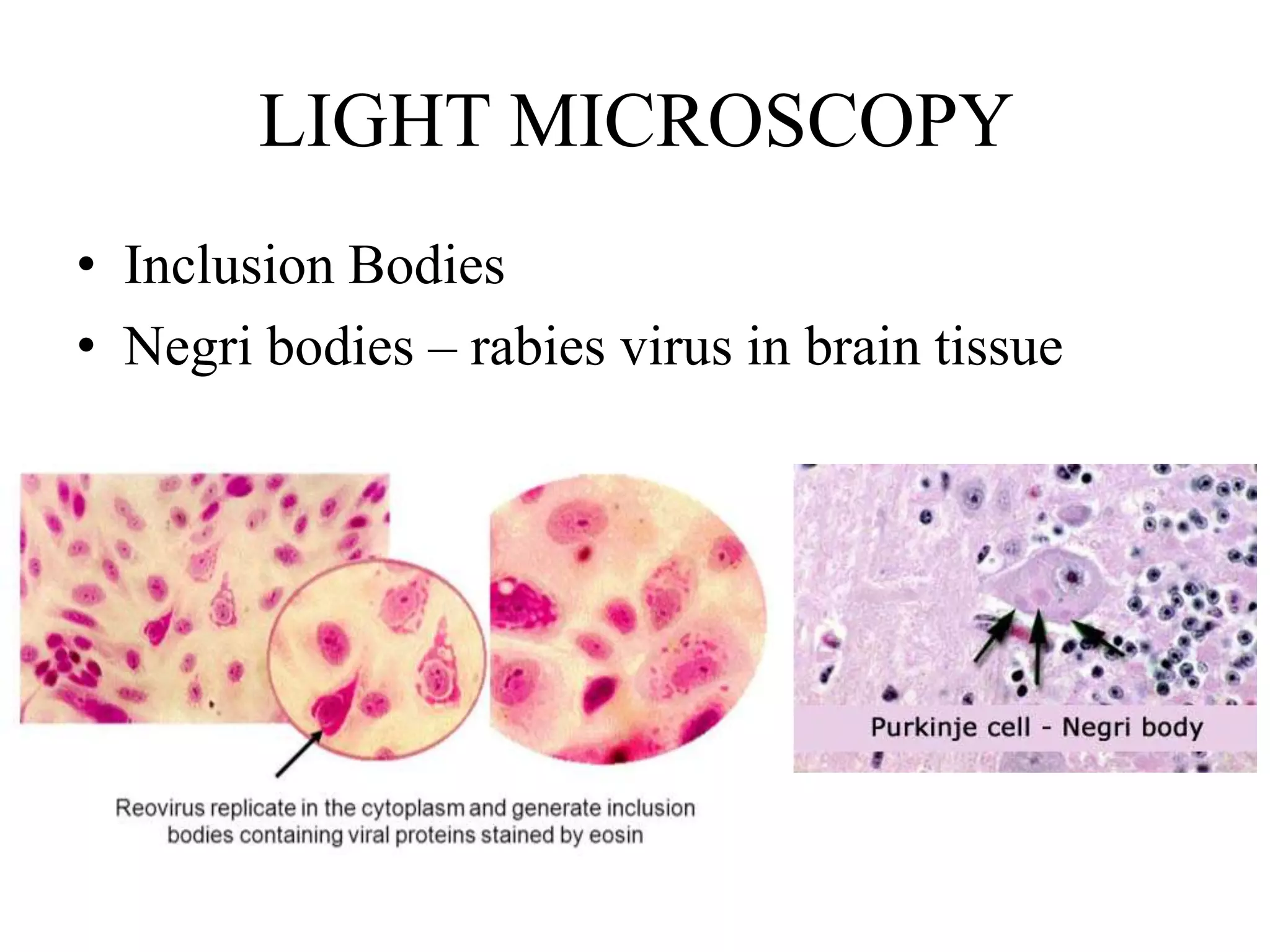 Lab diagnosis of viral infections | PPTX