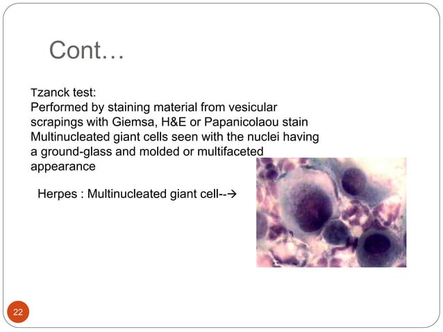 lab diagnosis of viral infections - mayuri.pptx