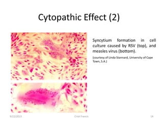 Lab diagnosis of viruses | PPTX