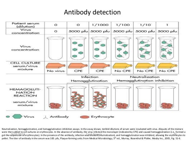 Lab diagnosis of viruses
