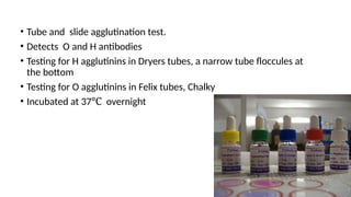 lab diagnosis salmonella for medical students.pptx