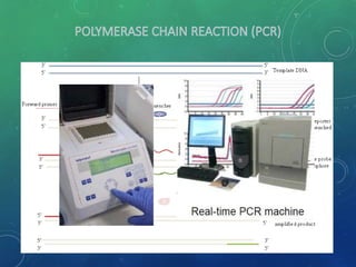 Lab diagnosis of viral infection | PPTX
