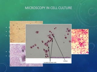 Lab diagnosis of viral infection | PPT