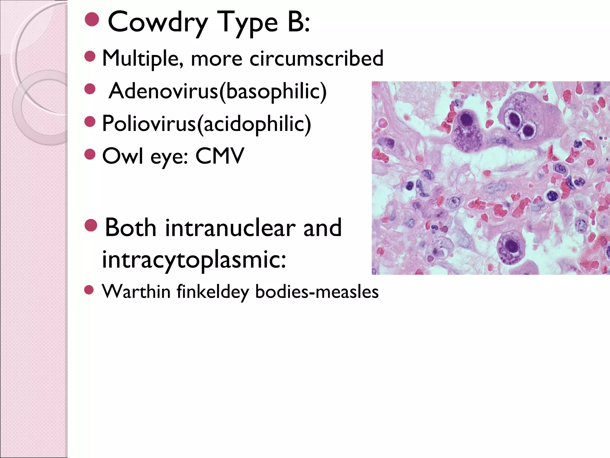 Laboratory diagnosis of viral infection | PPT