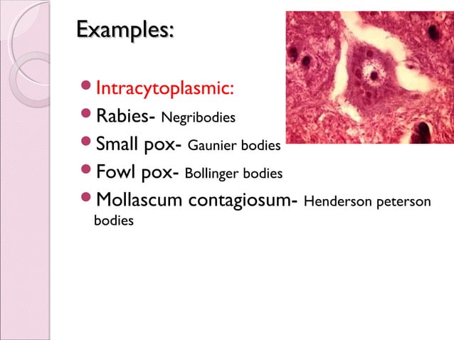 Laboratory diagnosis of viral infection | PPT | Infectious Diseases ...