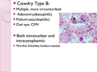 Laboratory diagnosis of viral infection | PPT
