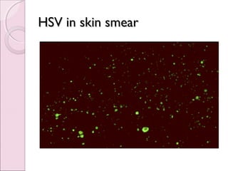 Laboratory diagnosis of viral infection | PPT