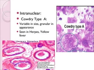 Cowdry Type A