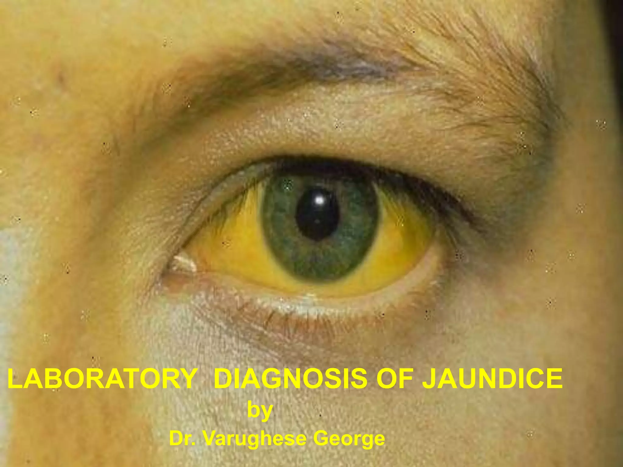 Laboratory Diagnosis of Jaundice | PPTX