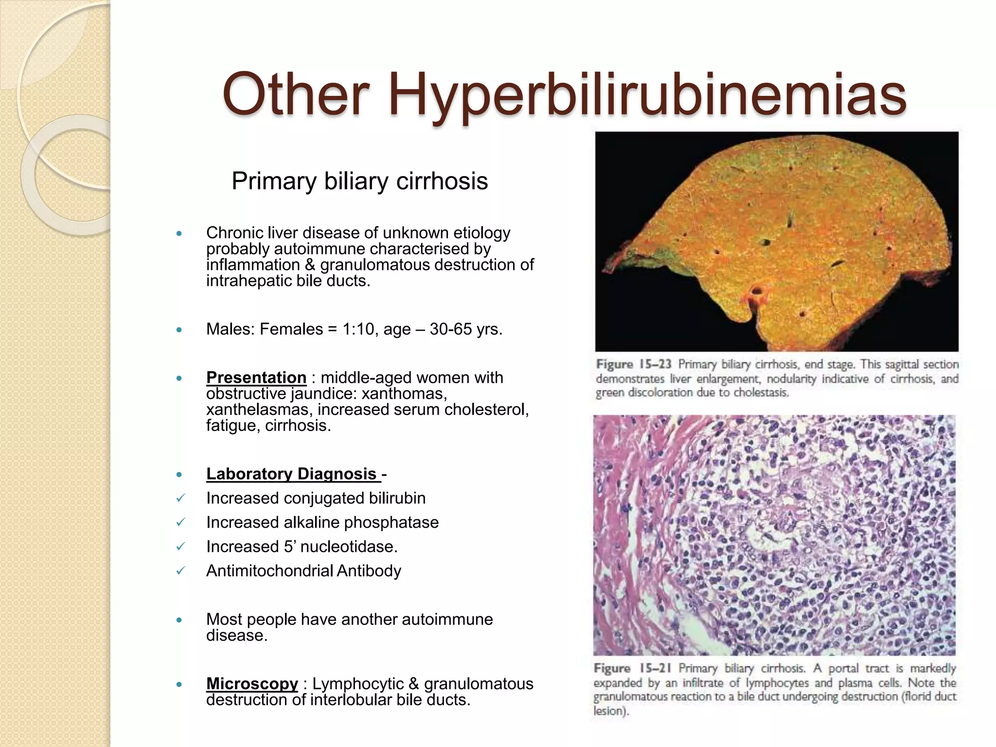 Laboratory Diagnosis of Jaundice | PPTX