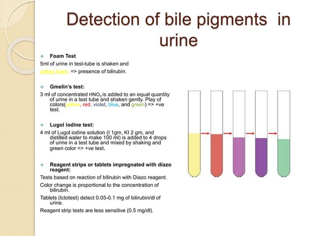 Laboratory Diagnosis of Jaundice | PPTX | Blood Disorders | Diseases ...