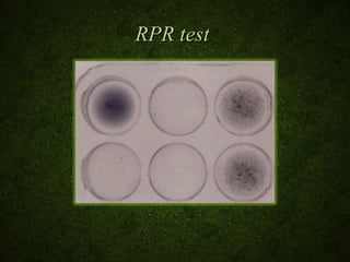 Lab diagnosis of syphilis | PPT