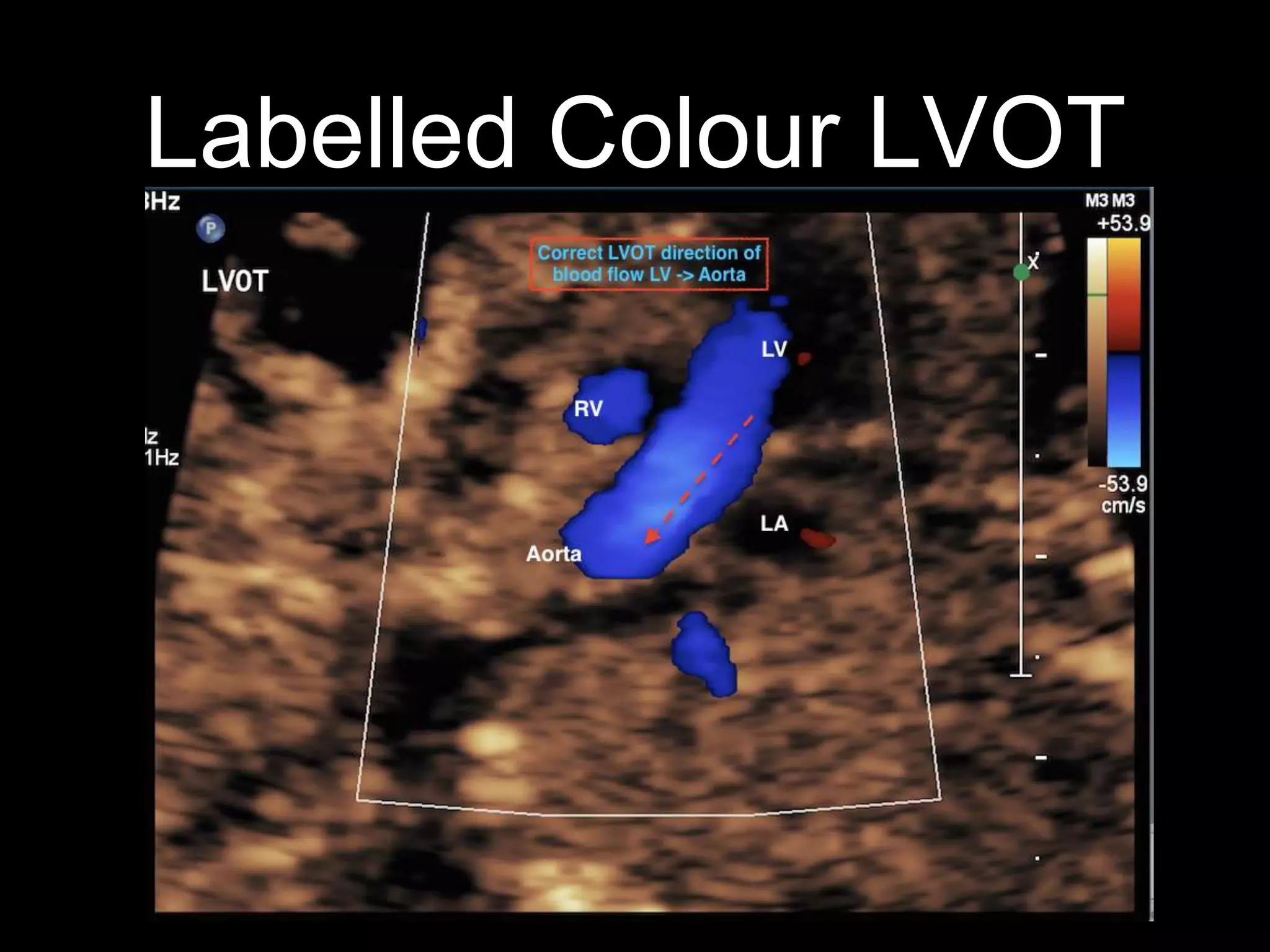 Labelled fetal heart ultrasound | PPTX