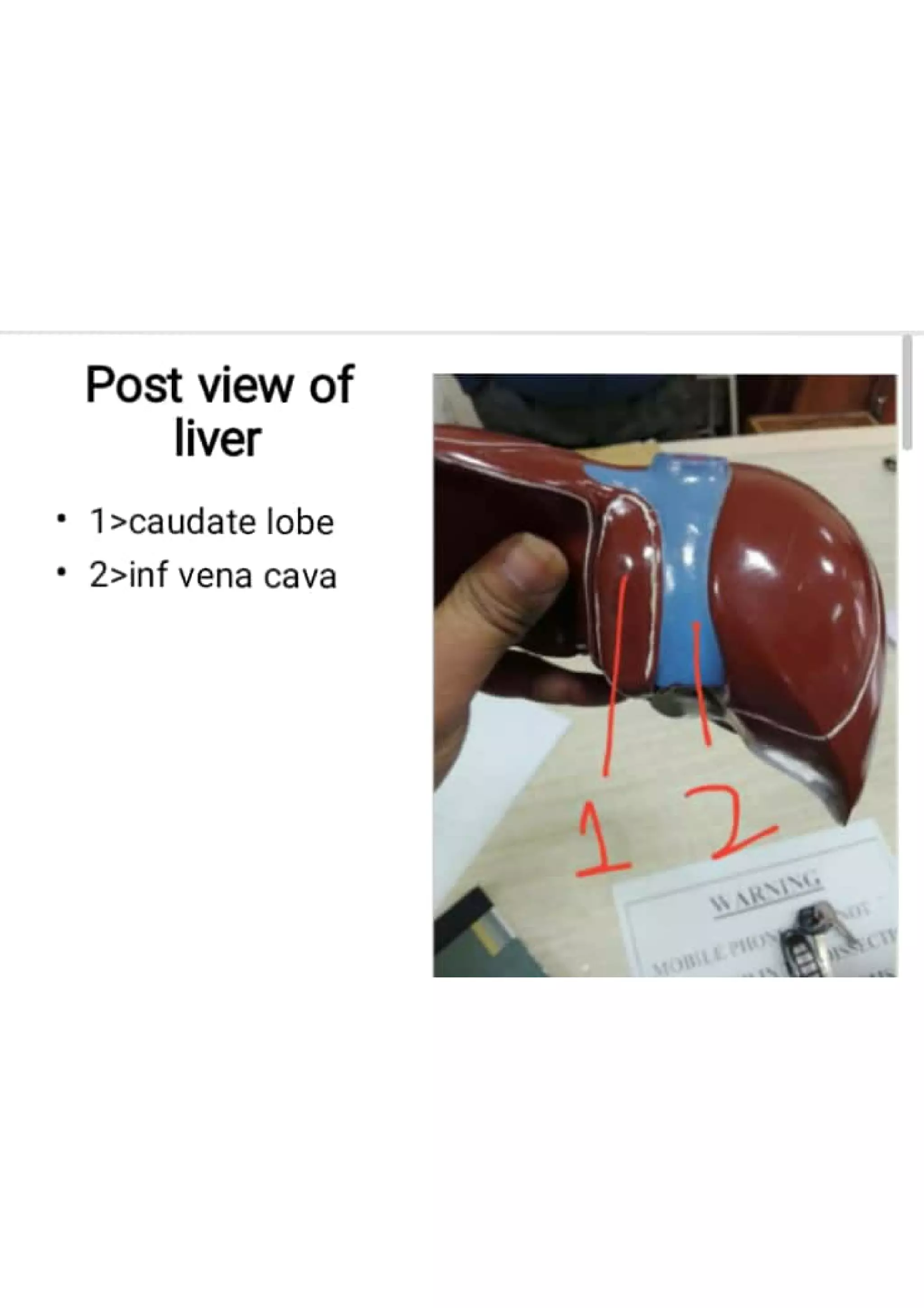 Labelled models of abdomen and pelvis OSPE | PDF