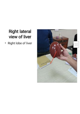 Labelled models of abdomen and pelvis OSPE | PDF