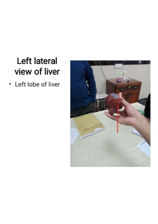 Labelled models of abdomen and pelvis OSPE | PDF