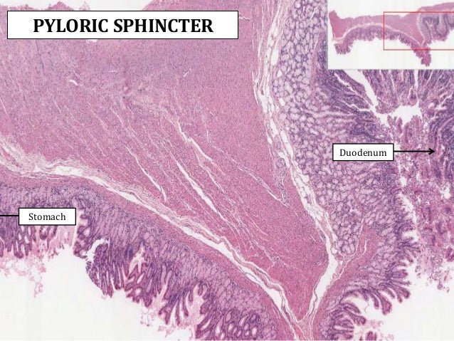 Pyloric Sphincter Histology