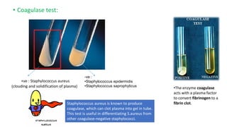 Identification of gram positive cocci | PDF
