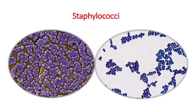 Identification of gram positive cocci