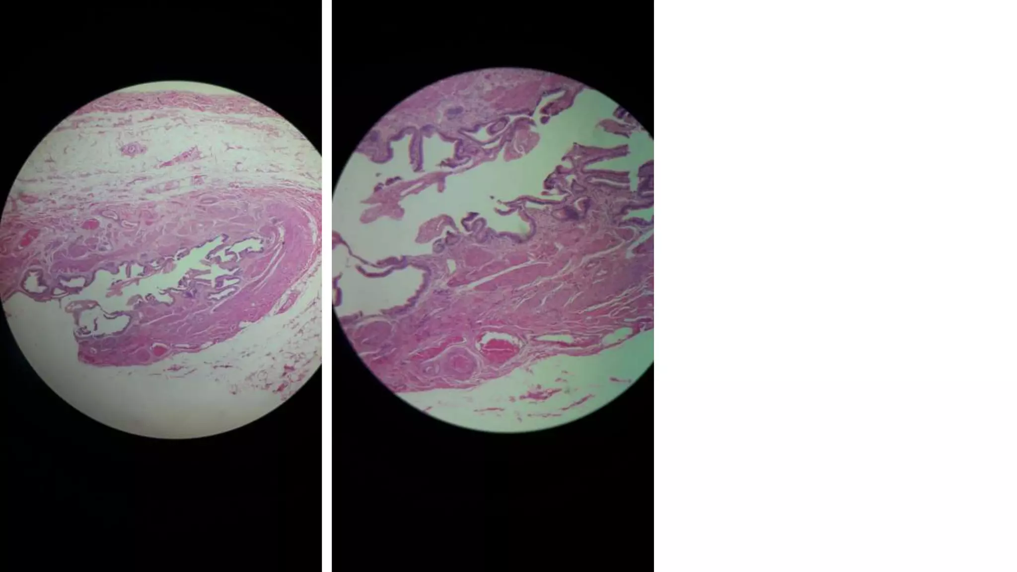 histology slides of GIT system | PPTX