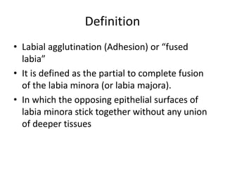 Labial adhesion | PPTX