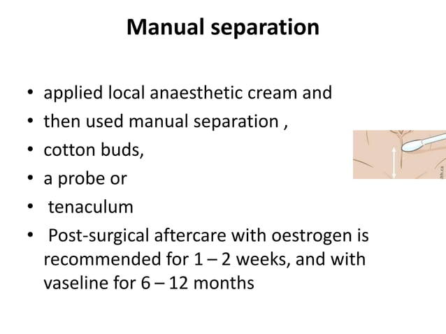 Labial adhesion | PPTX
