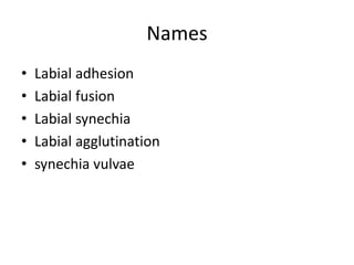 Labial adhesion | PPTX