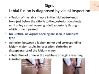 Labial adhesion | PPT