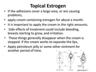 Labial Adhesions In Adults