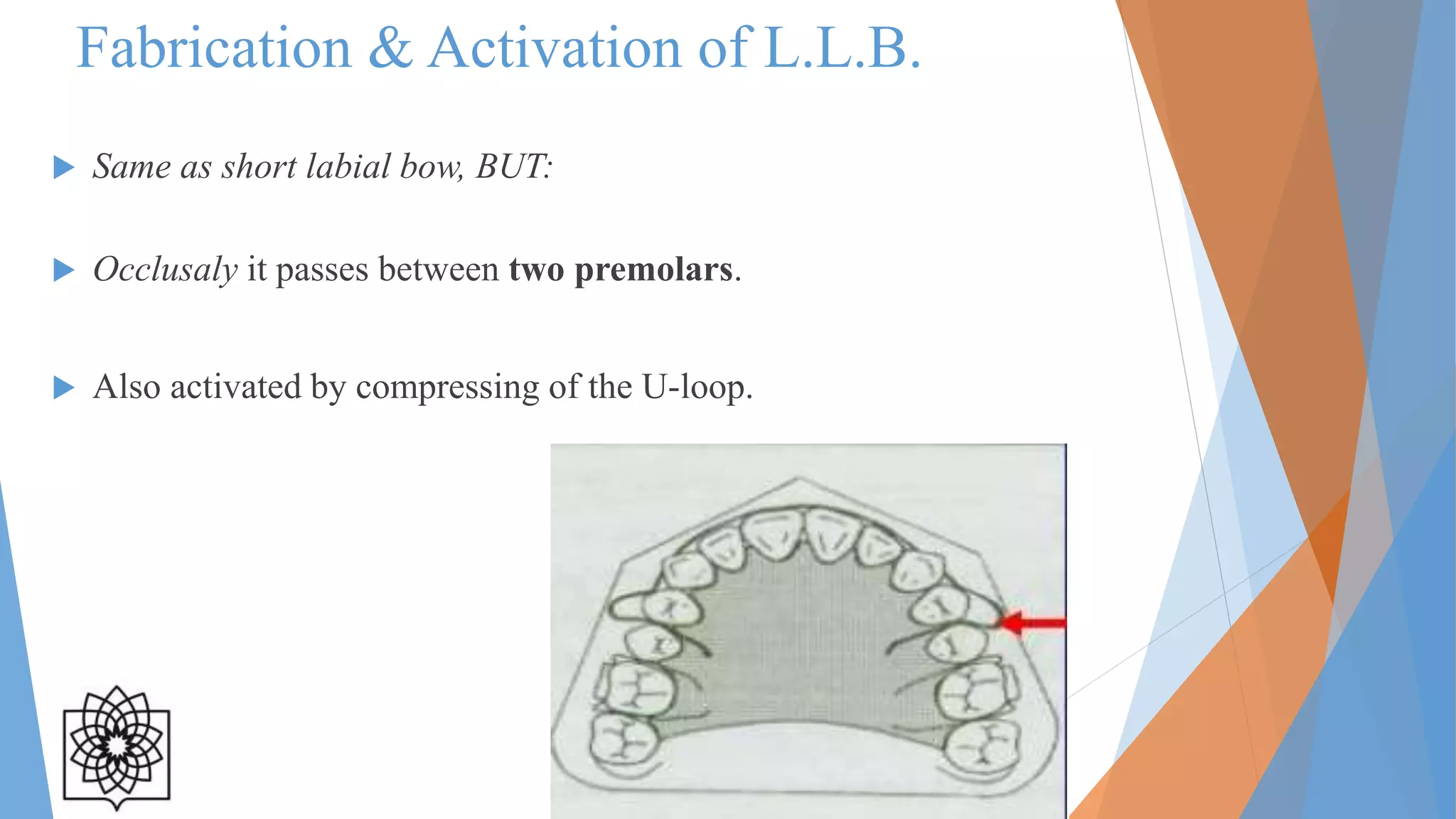 Labial bow Functions , Constructions , Types & Indications. | PPTX