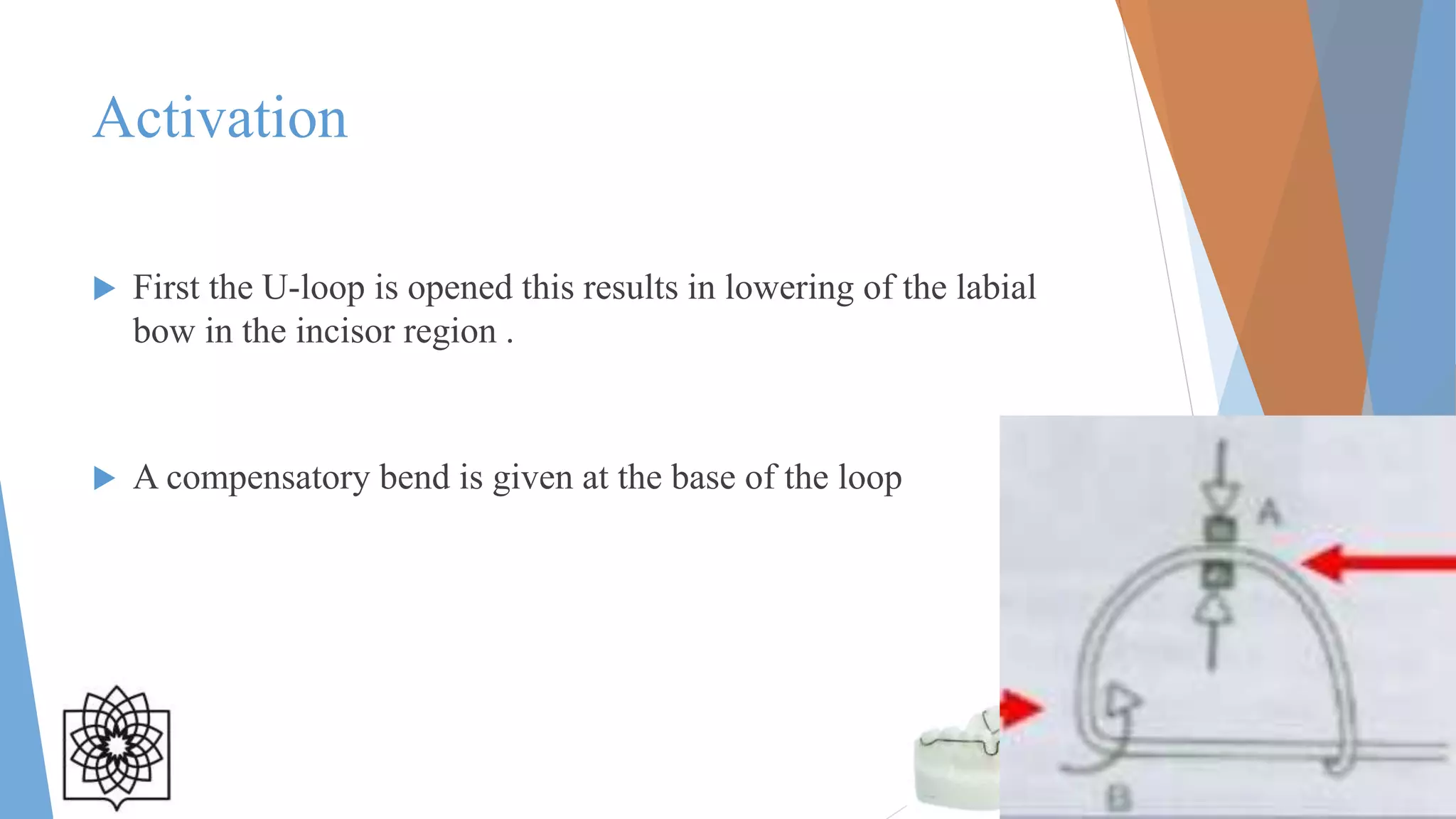 Labial bow Functions , Constructions , Types & Indications. | PPTX