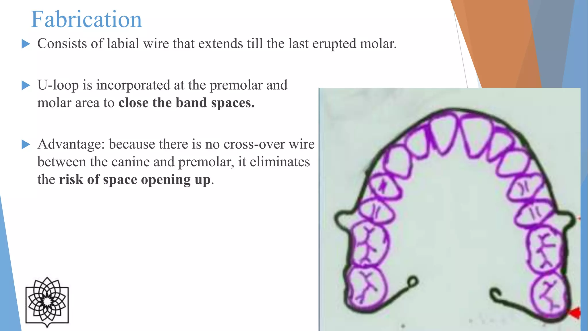 Labial bow Functions , Constructions , Types & Indications. | PPTX