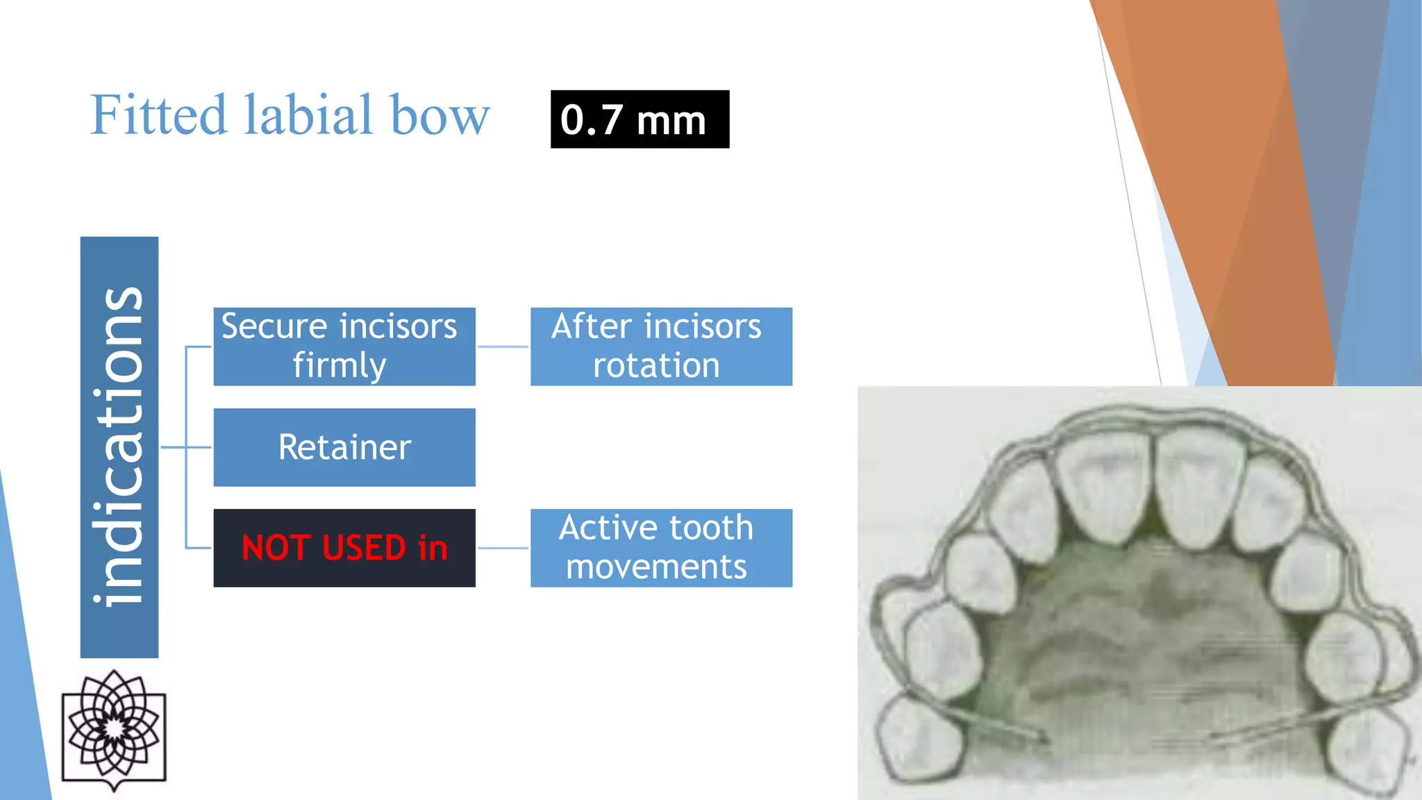 Labial bow Functions , Constructions , Types & Indications. | PPTX