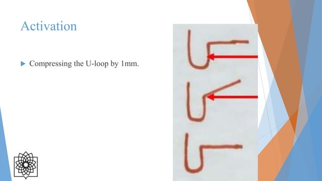 Labial bow Functions , Constructions , Types & Indications. | PPTX ...